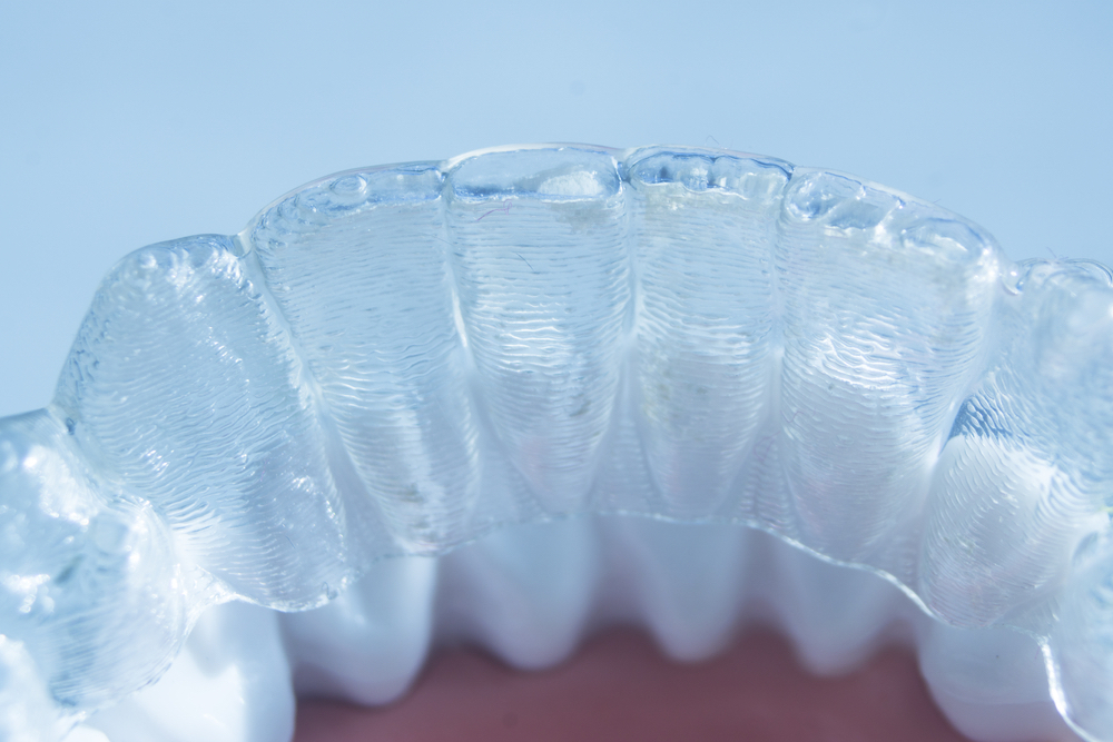 Clear Aligners - HCI Dentistry | Hermitage, TN